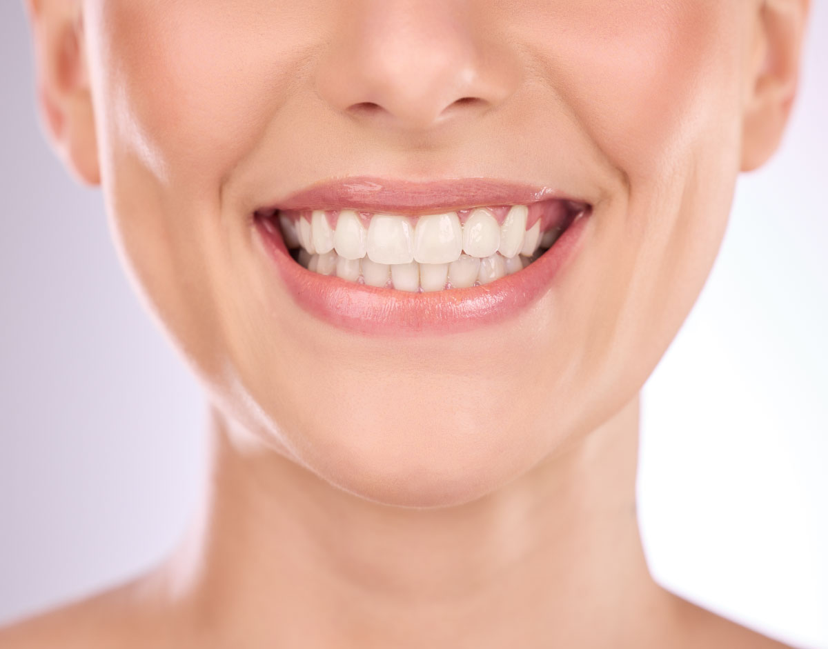 Aligner Treatment – Oegao